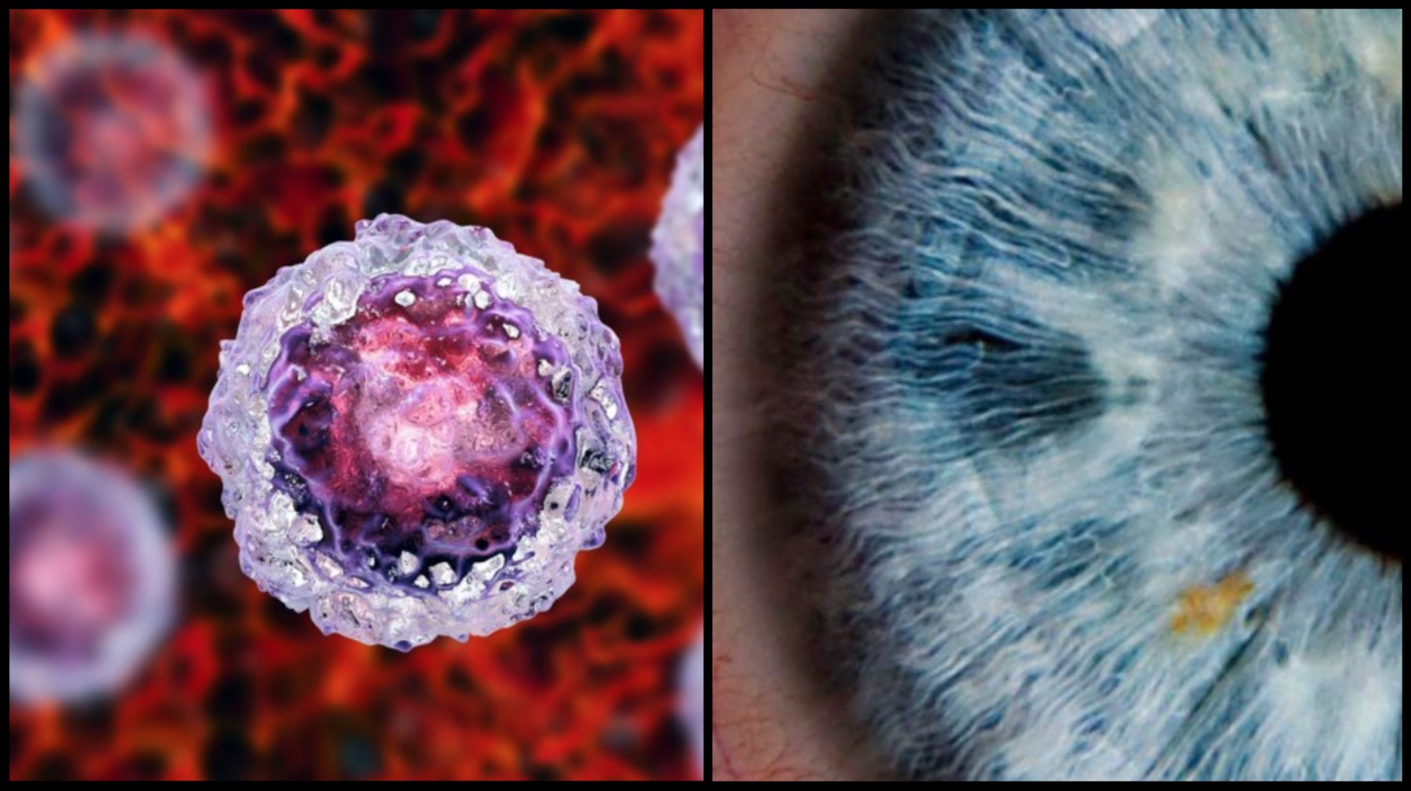 Passi importanti nella sperimentazione clinica per la retinite ...